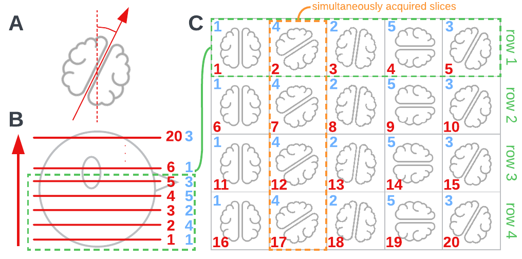 Empirically determining slice acquisition order of Philips Achieva ...