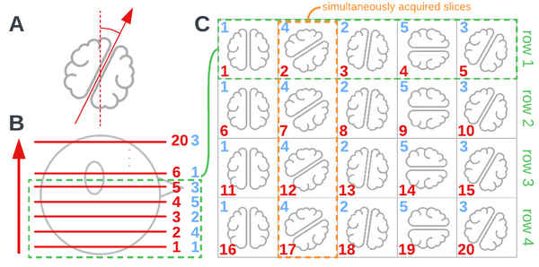 Empirically determining slice acquisition order of Philips Achieva MultiBand BOLD sequences